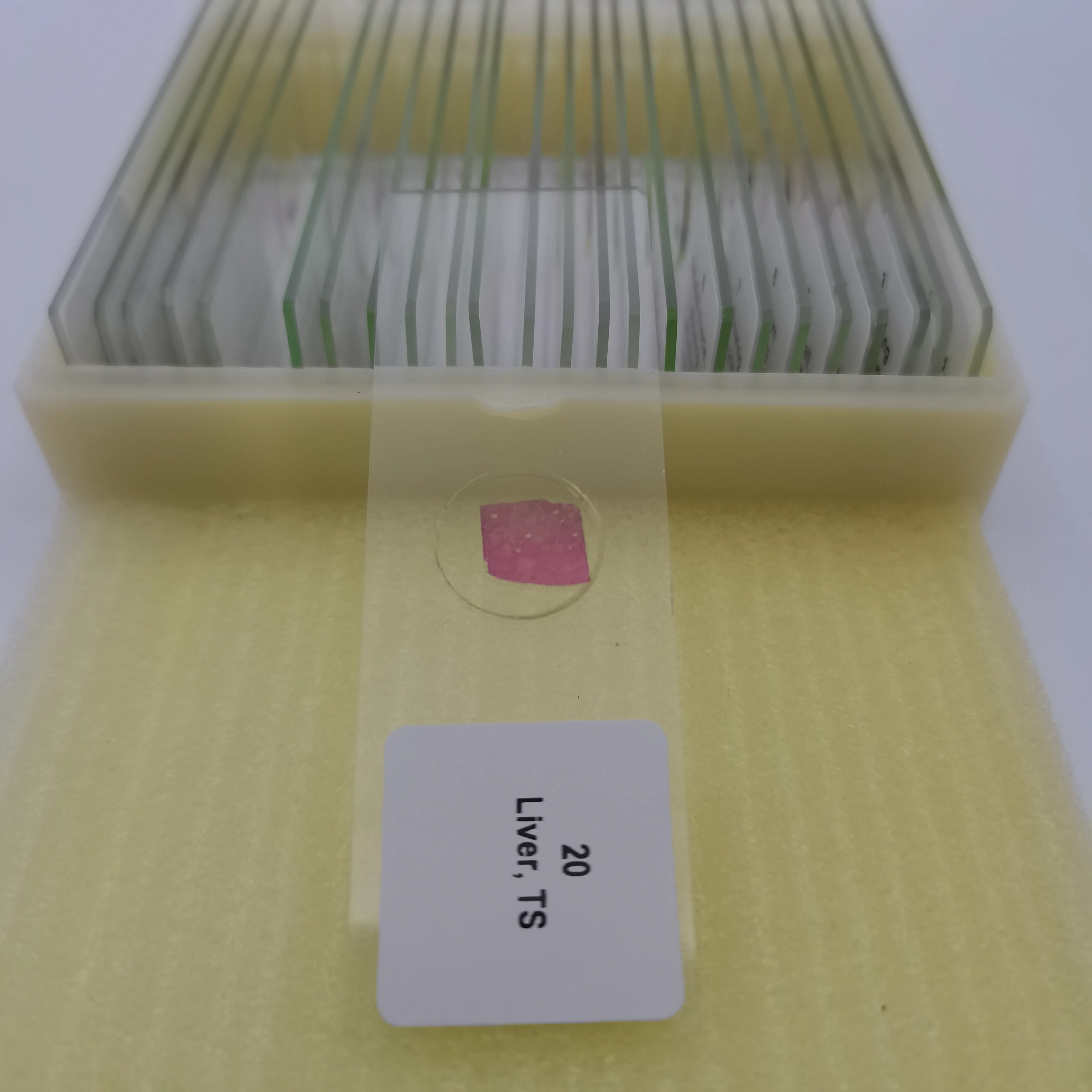 Histology Slides Set Basic Fixed 25pcs Glass Histology Prepared ...