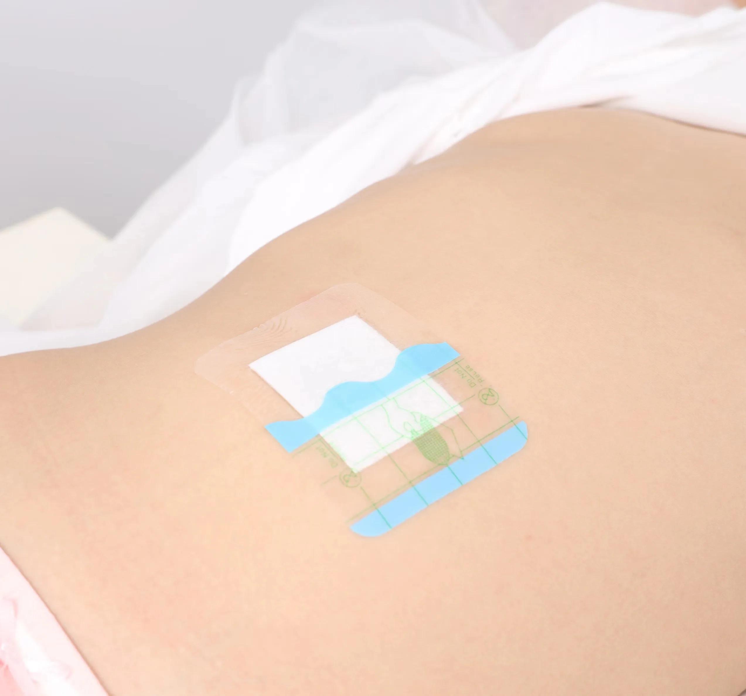 Navel Care Dressing For Baby Waterproof Navel Care Dressing Waterproof ...