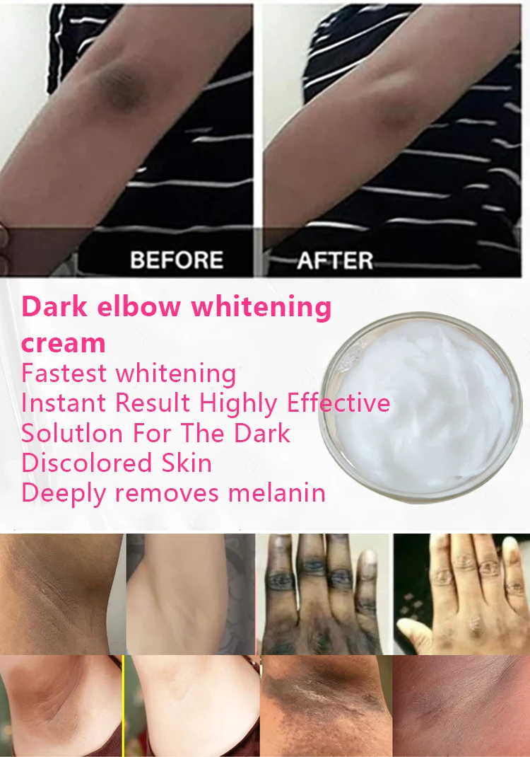 Elbow Whitening