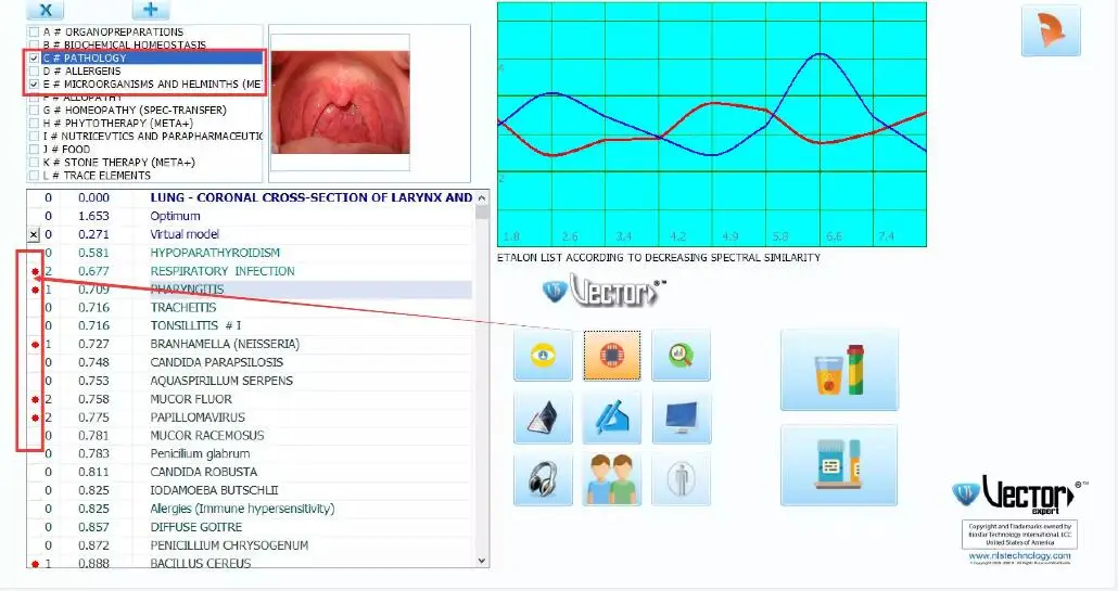 Portable Body Scanner - Biofeedback Health Analyzer