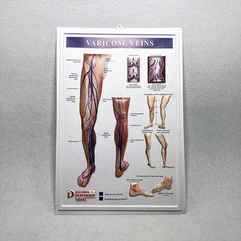 3d Embossed Medical Wall Chart For Hospital - Buy 3d Embossed Wall ...