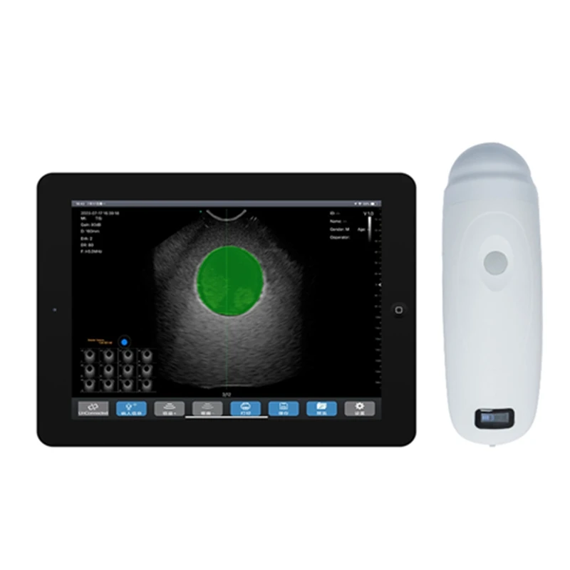 Upgrade 4D Wireless Handheld Ultrasound Bladder Scanner New Ai ...