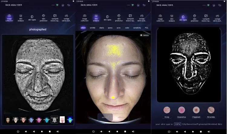 Face Analysis Facial 3d Skin Scanner Facial Analysis Machine Facial ...