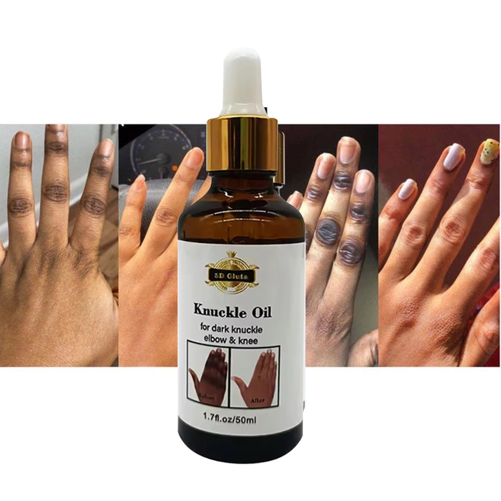 Oem Get Rid Of Dark Knuckles Serum Remover Dark Elbows Knees Super Skin ...