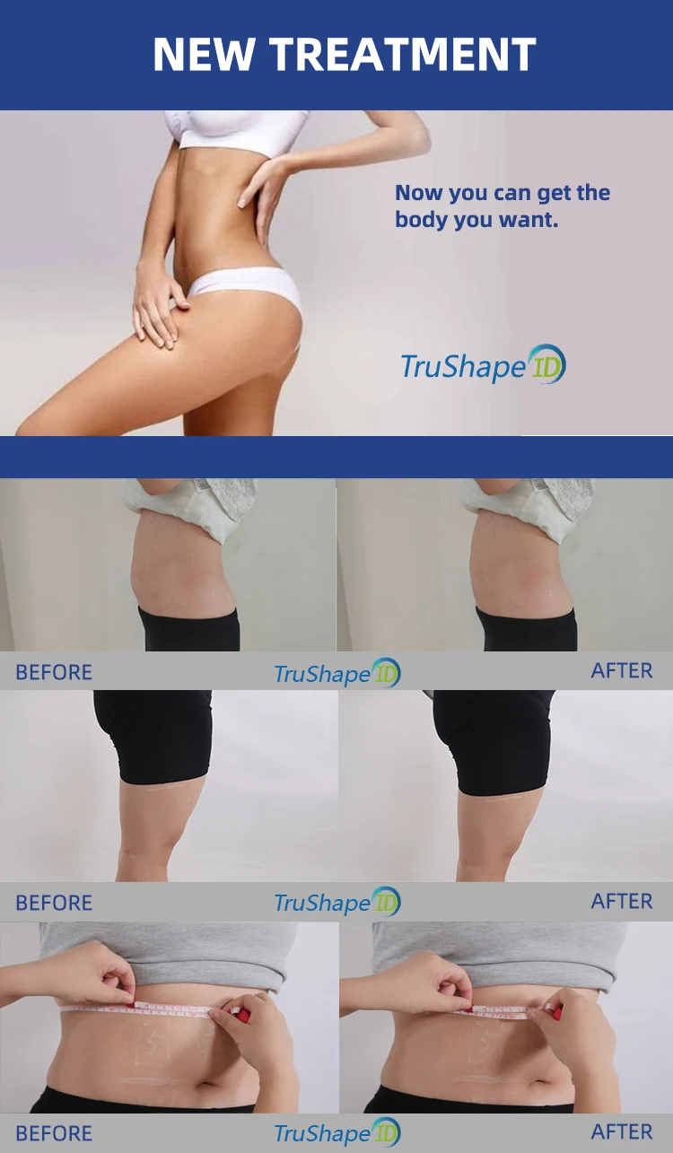 Trushape-ID-_08.jpg