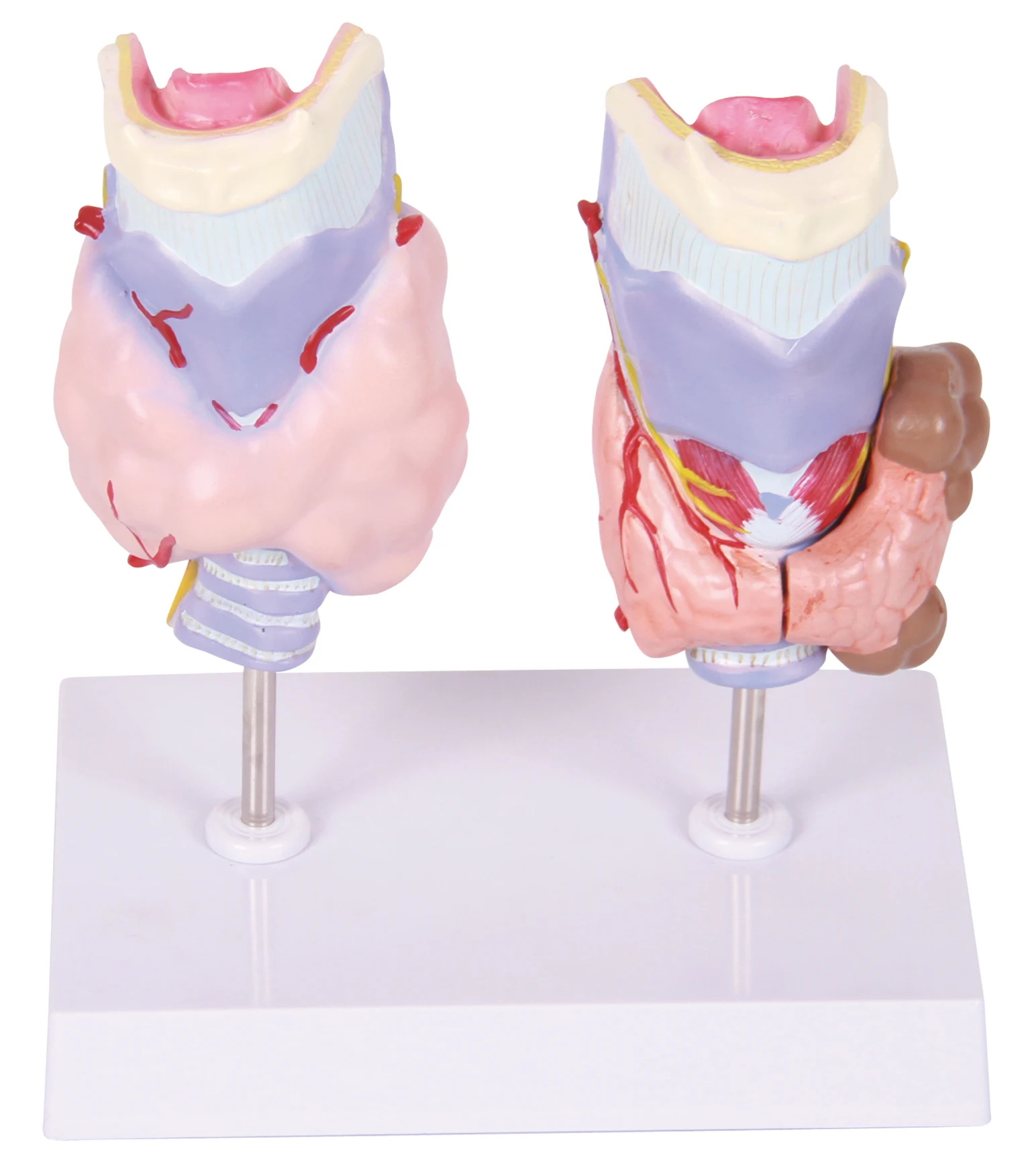 Human Thyroid Gland Model Thyroid Pathology Models - Buy Thyroid Gland ...