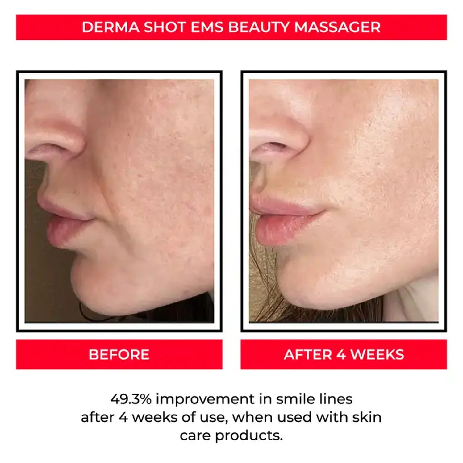 Medicube Age R Device Electric Shape Microcurrent Face Skin Roller Ems ...