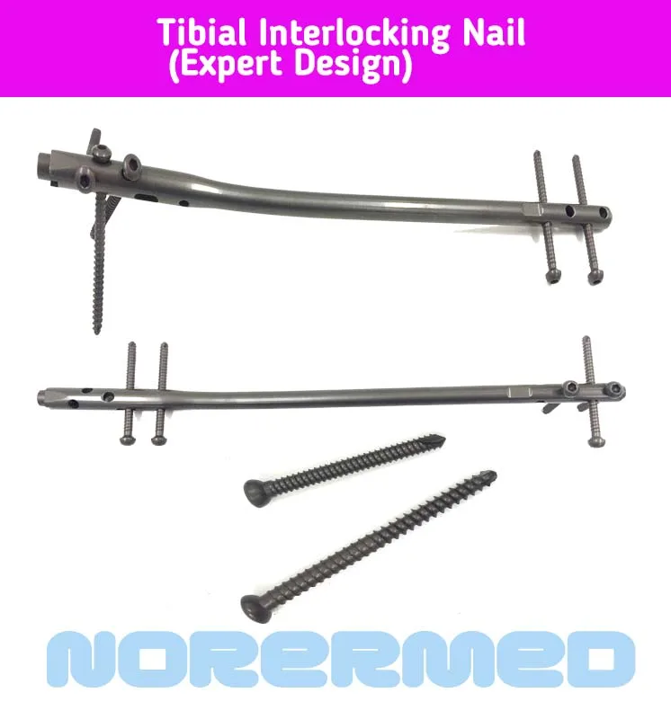 Titanium Orthopedic Tibial Interlocking Nail - Expert Type