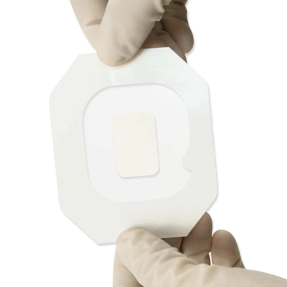 Medical Island Wound Dressing Catheter Fixation Device Transparent Iv ...