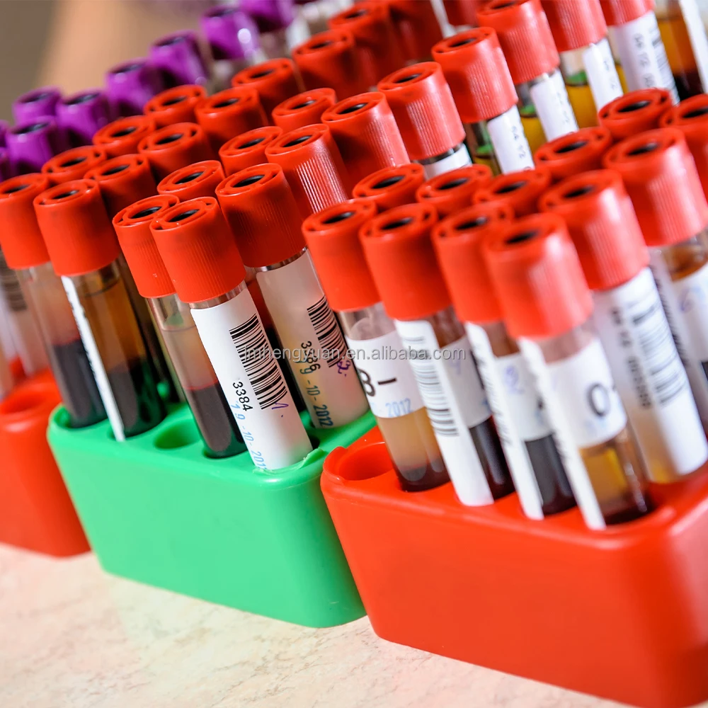 Custom Size Refrigeratated Pharmaceutical Self Adhesive Paper Blood Bag ...