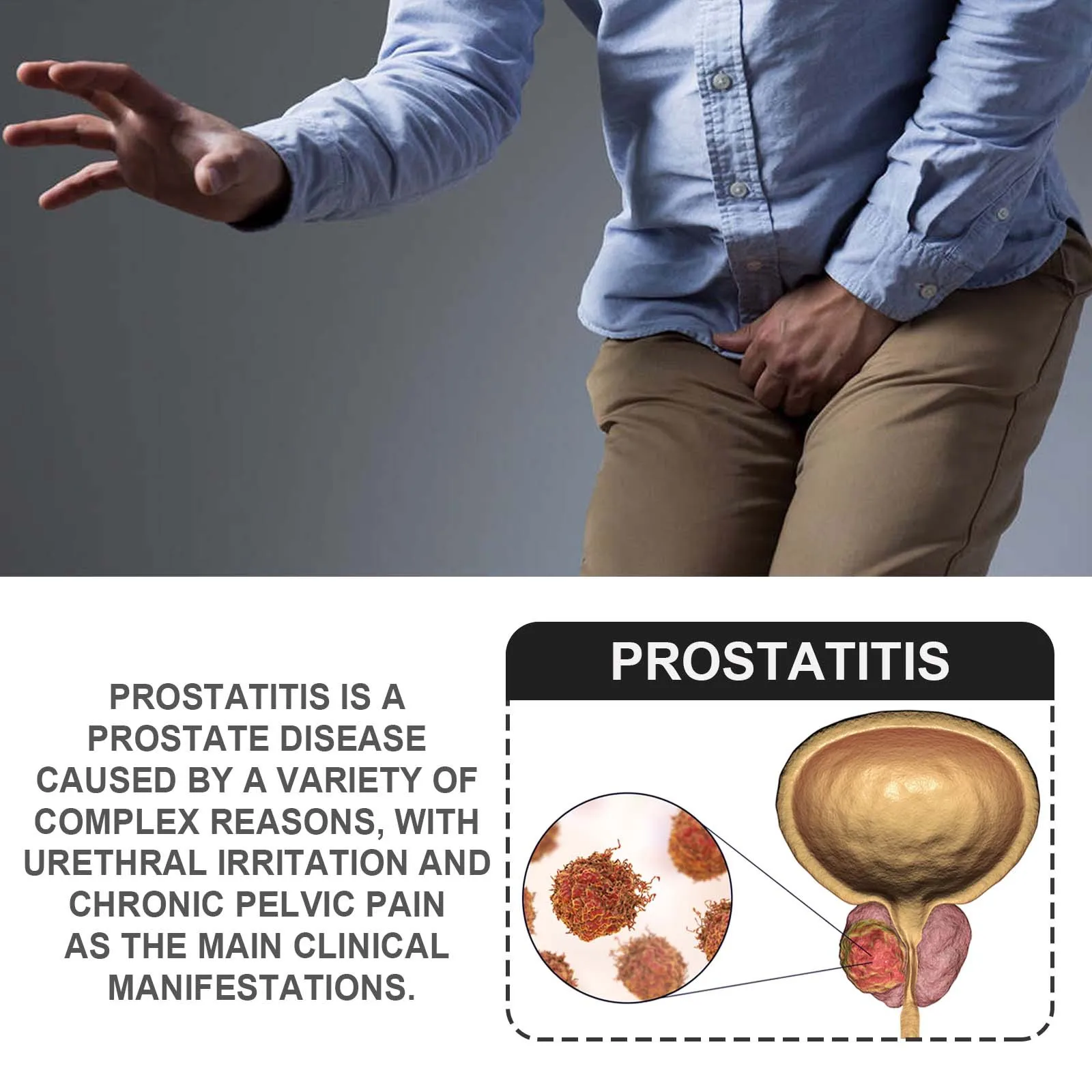 Treatment Prostate Hypertrophy Calcification Scrotal Moisture Frequent