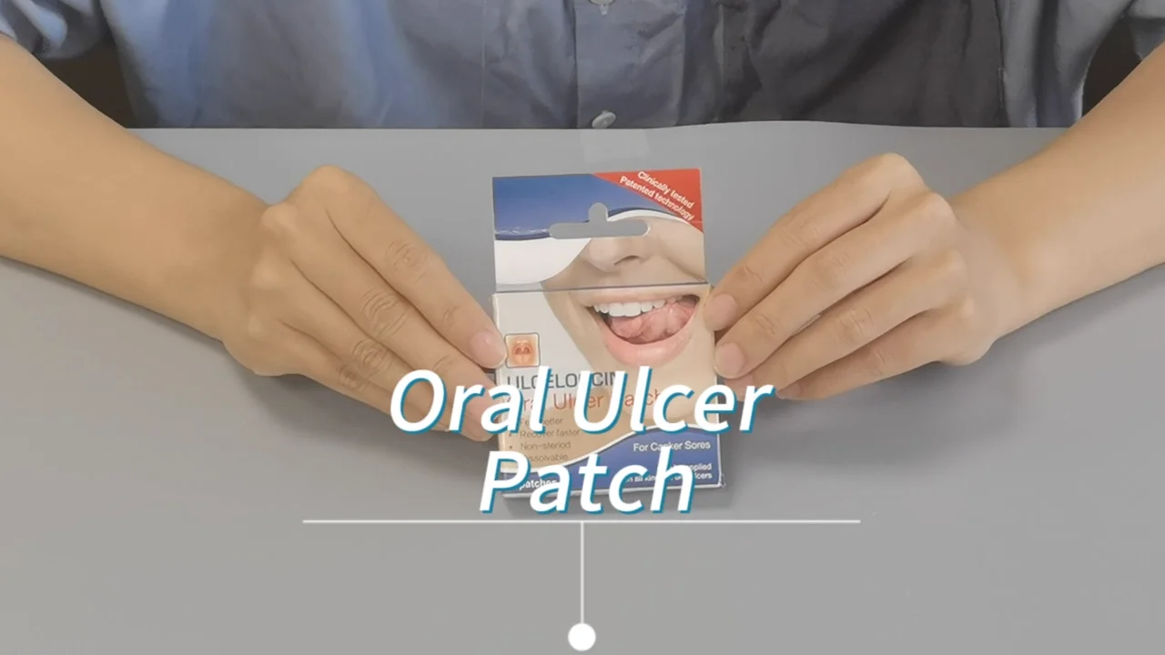 Bluenjoy Medical Disposable Oral Mouth Ulcer Patch Pad Easy To Use Dissolvable Mouth Ulcer Film ...