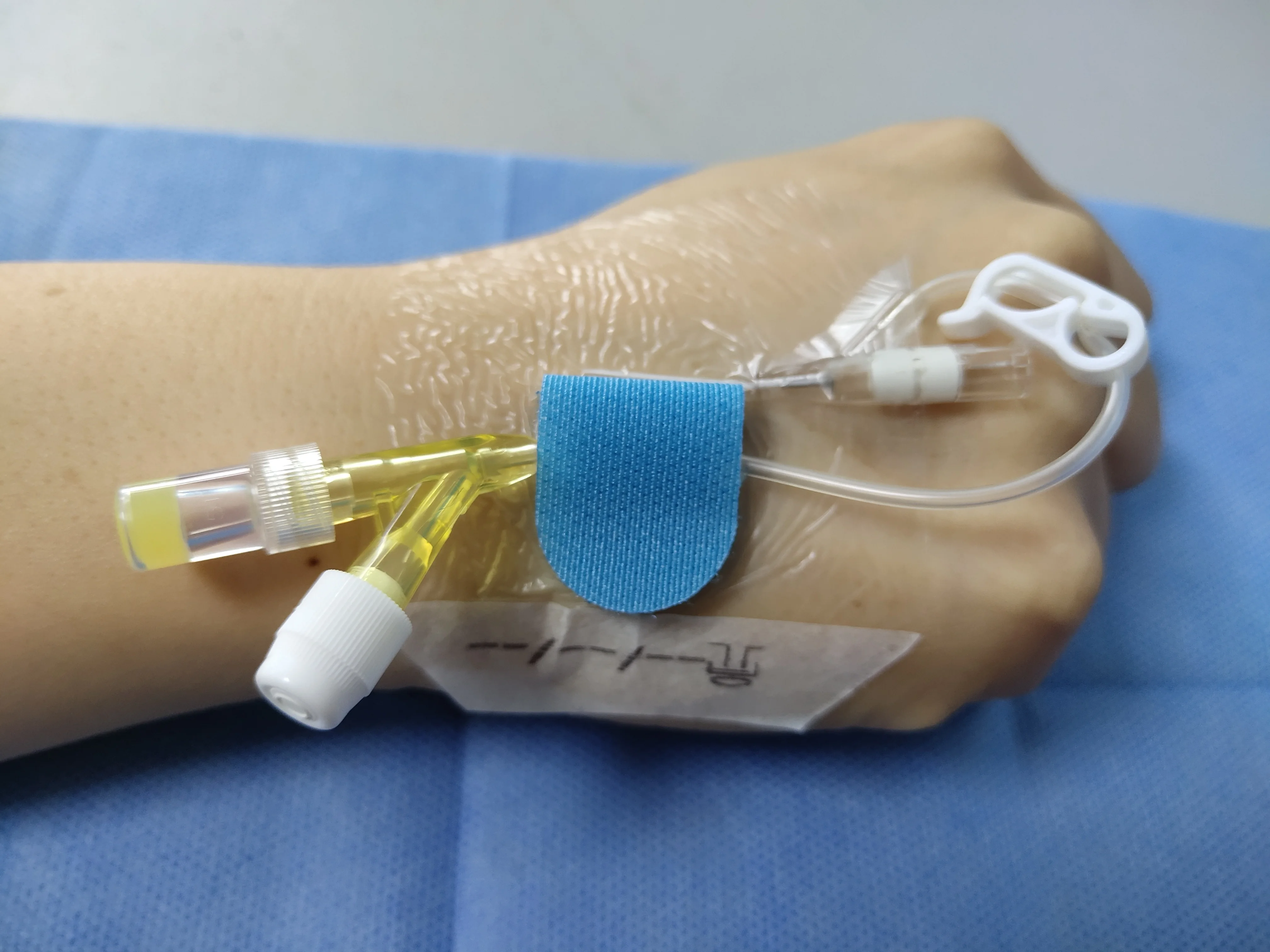 Iv Cannula Fixing Catheter Securement For Hospital And Clinic Use ...