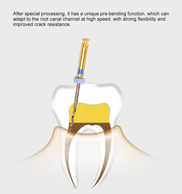Rotary Files Rainbow Dental Heat Activation Blue Gold Files - Buy Gold ...