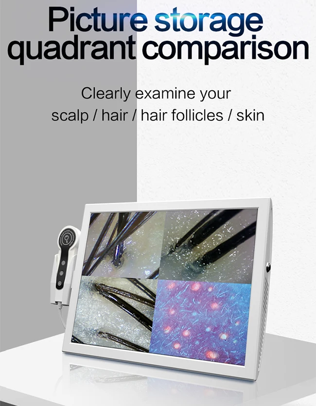 Sa-s04a Portable Skin Tester Wrinkle Analysis Hair Analyzer Scalp ...