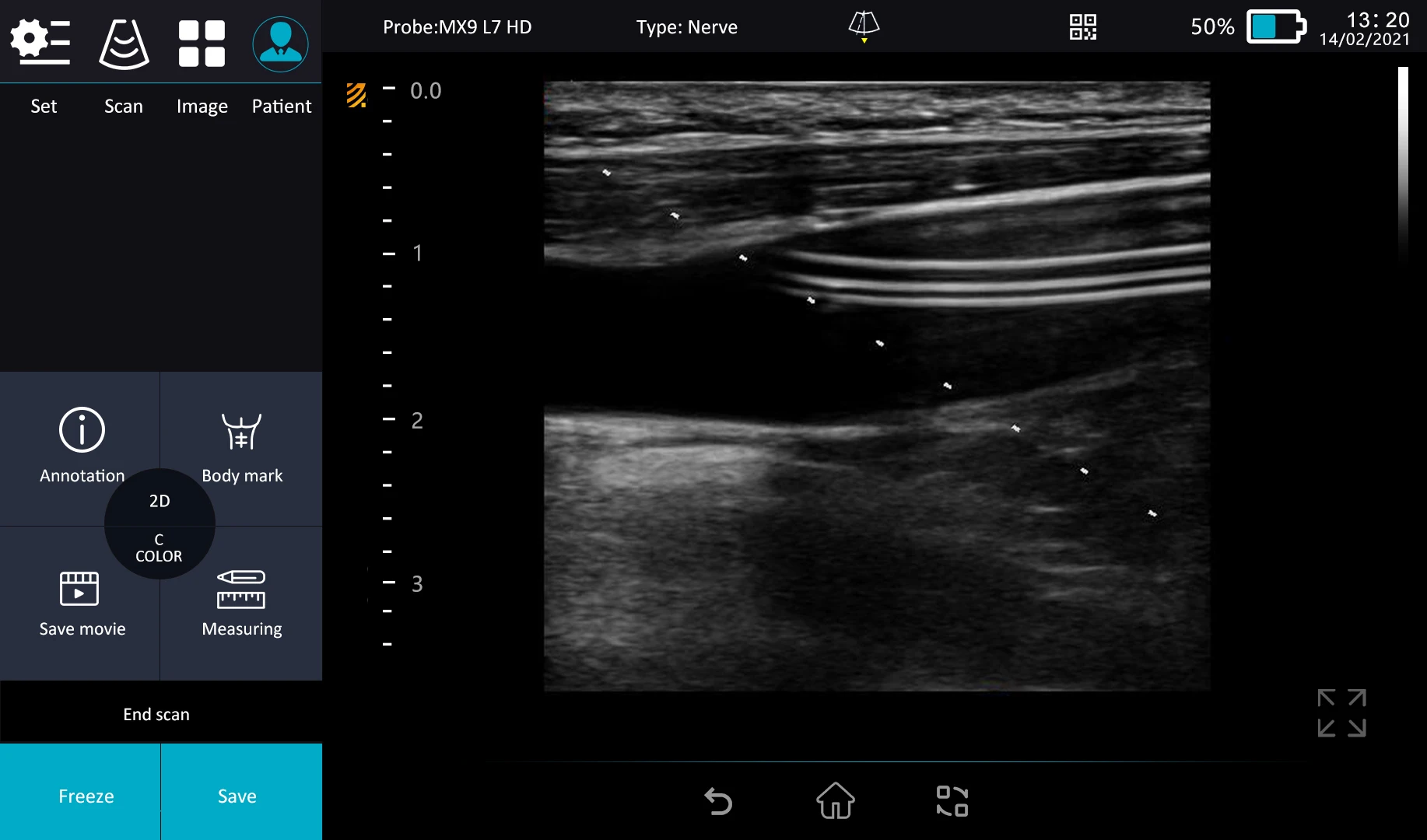 USB Ultrasound Medical Scans - Convex Linear Probe BMV MX9