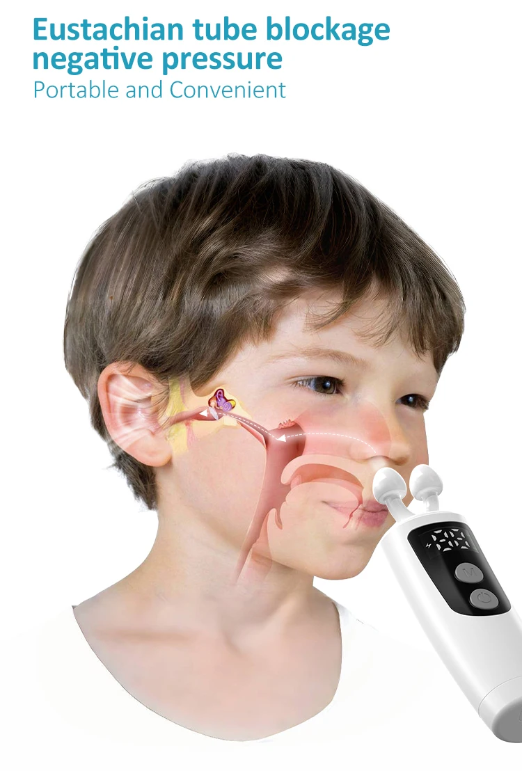 Eustachian Tube Blower Adjusting Ear Pain Pressure Balance Otitis Media ...