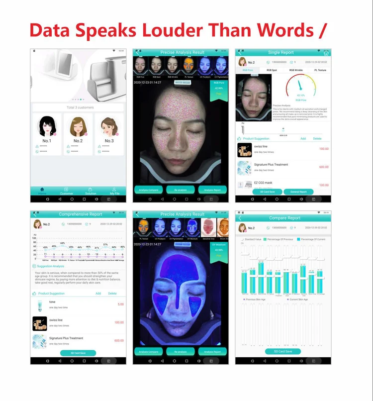 1500W pixel HD Camera Artificial Intelligence Skin Detector Scanner ...