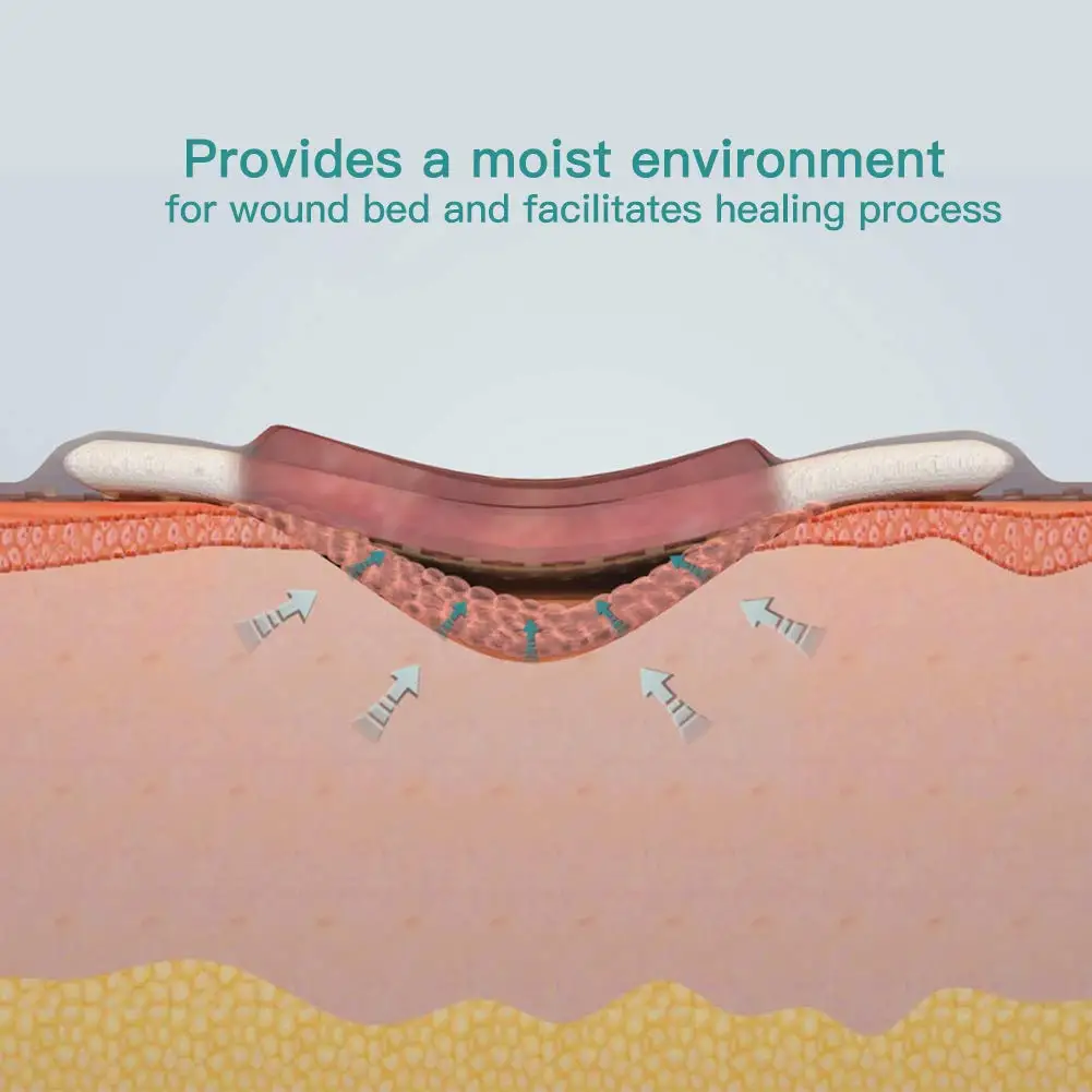 Medical Product Alginato Pressure Ulcer Diabetic Wound Foot Care Silver ...