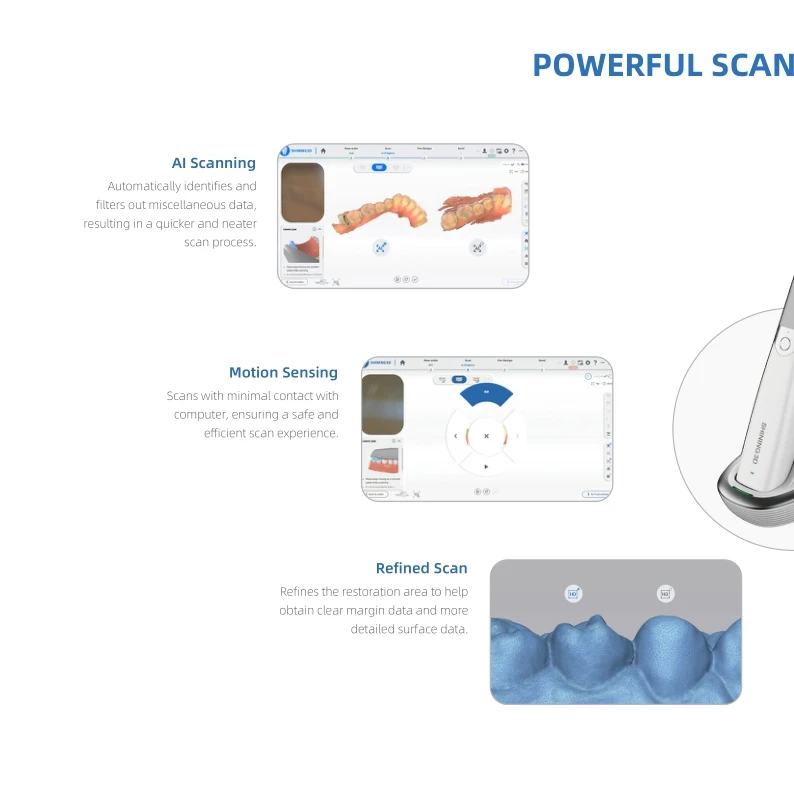 Wireless Scanner Intraoral 3d Intraoral Scanner Manufacturers High ...