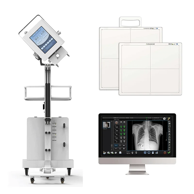 Iray Medical X-Ray Equipments & Accessories - Digital X Ray Machine ...