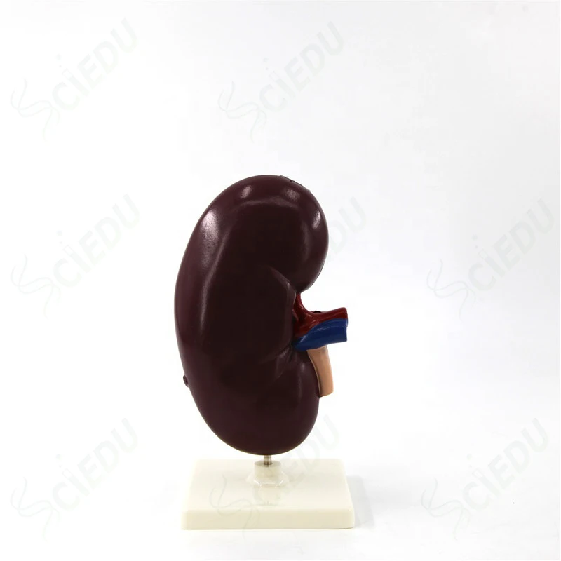 Medical Science Anatomy Kidney Model Teaching Resource Aids Anatomy ...