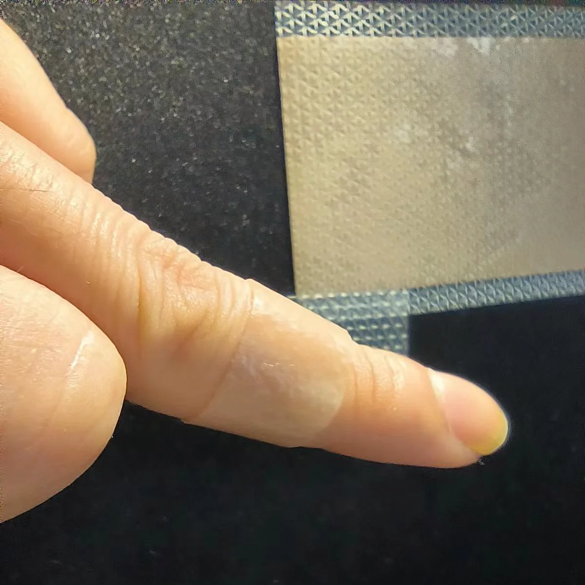 Reusable Waterproof Skin Color Scar Patch Silicone Gel Scar Paste ...