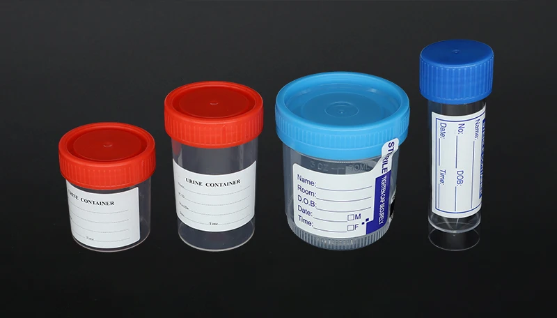 Sputum & Urine Specimen Containers - Sterile & Durable