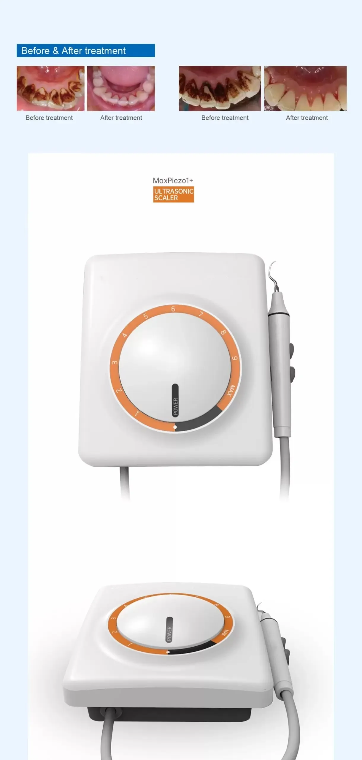 Portable Cavitron Electric Teeth Cleaning Clinic Scaler Dental ...