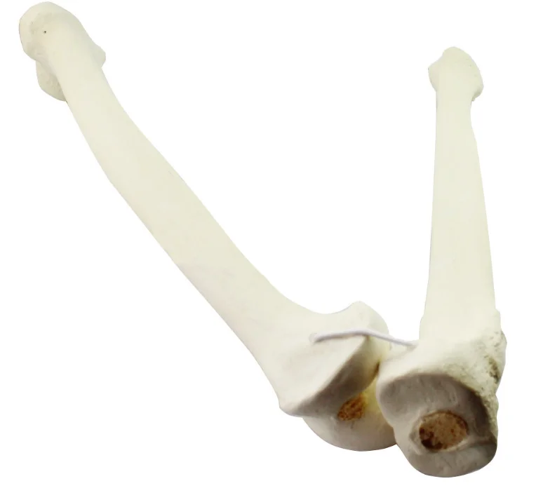 Human Tibia And Fibula Bone Model For Medical Learning And Training ...