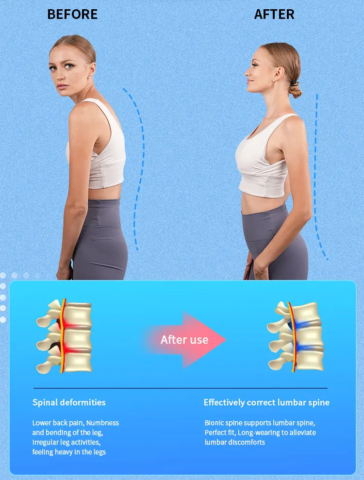 Custom Logo Adjustable Lower Back Straight Pain Relief Pilates Spine ...