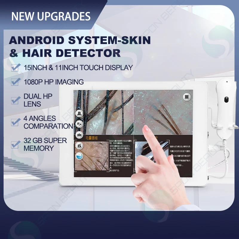 High Quality HD Hair Follicles Scalp Scanner Detector Hair Analyzer ...