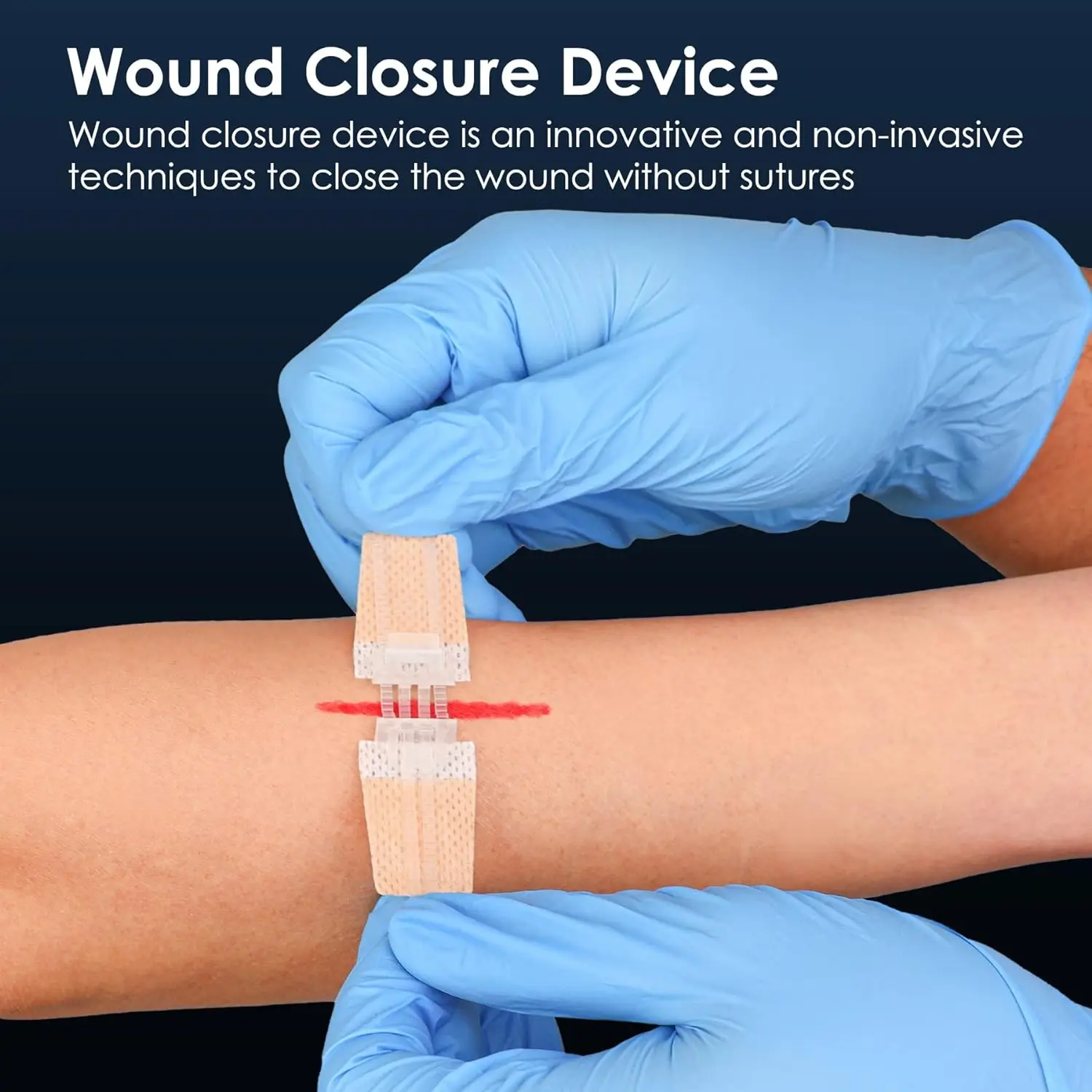 Zip Sutures Wound Closure Device(Non-Woven Fabric) Wound Care Butterfly ...