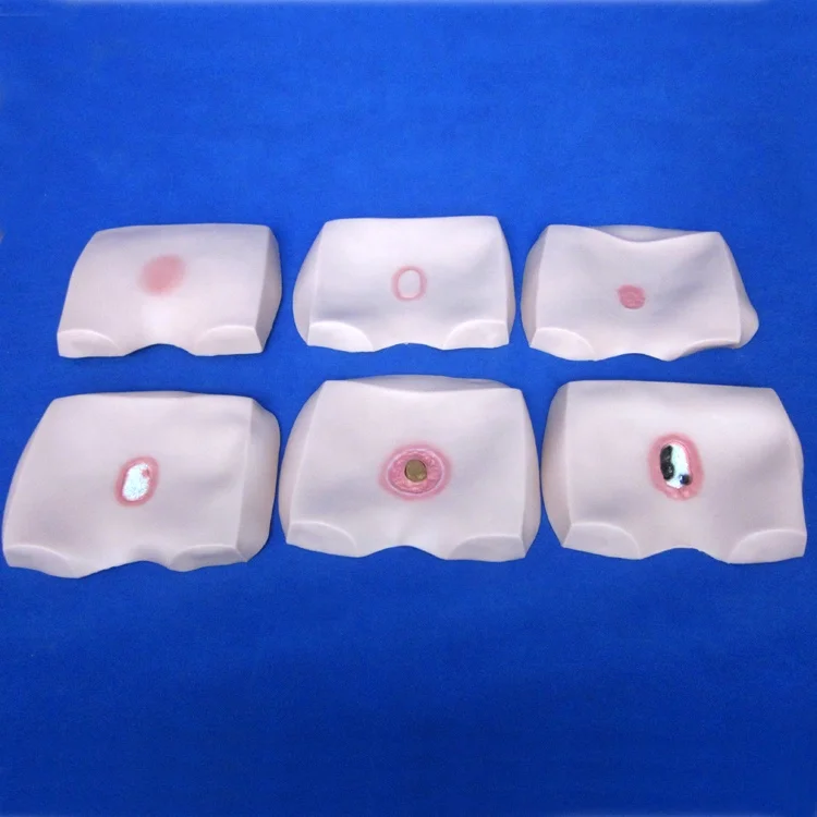 Quality Stages of Decubitus Ulcer Nursing Care Model| Alibaba.com