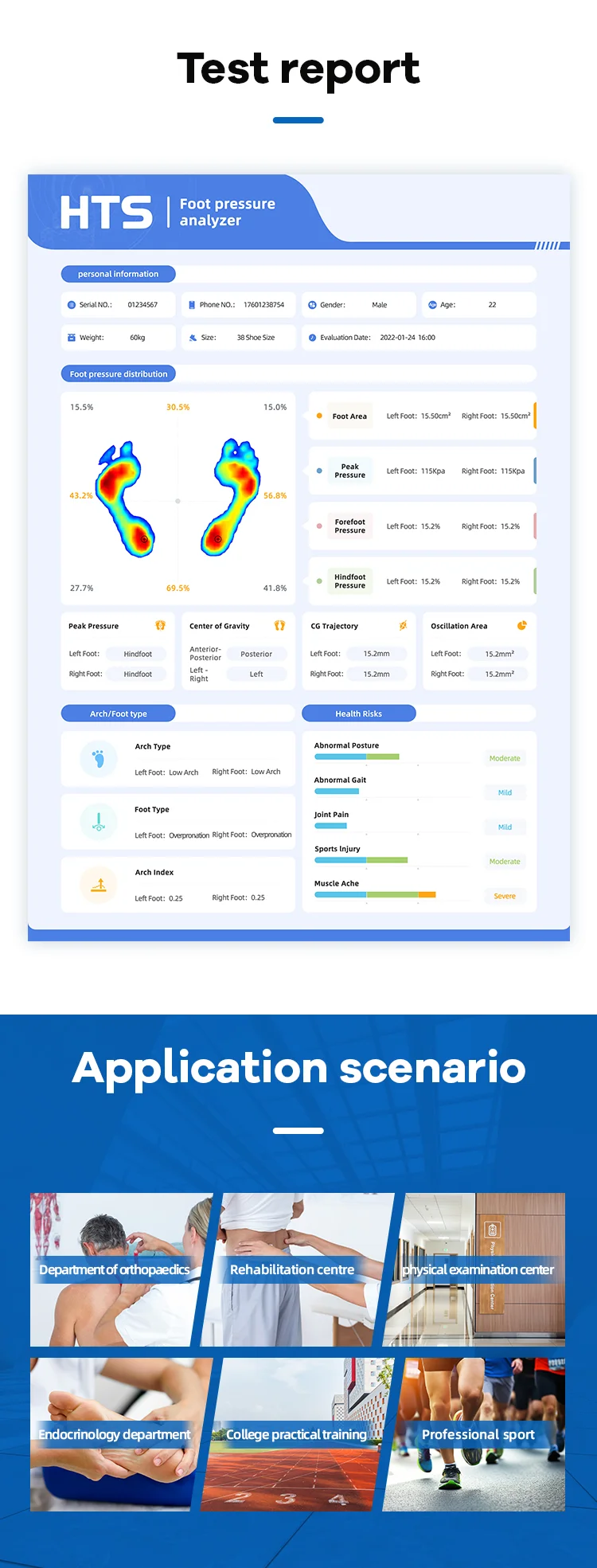 Factory Wholesale Foot Scanner 3d Foot Scanner Flat Foot - Buy Foot ...