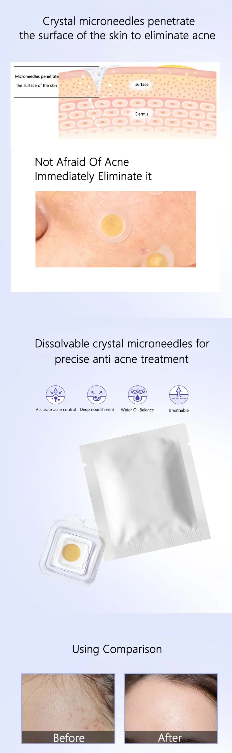 OEM Hydrocolloid Microneedle Patch for Early Stage Acne Skin Care Spot ...