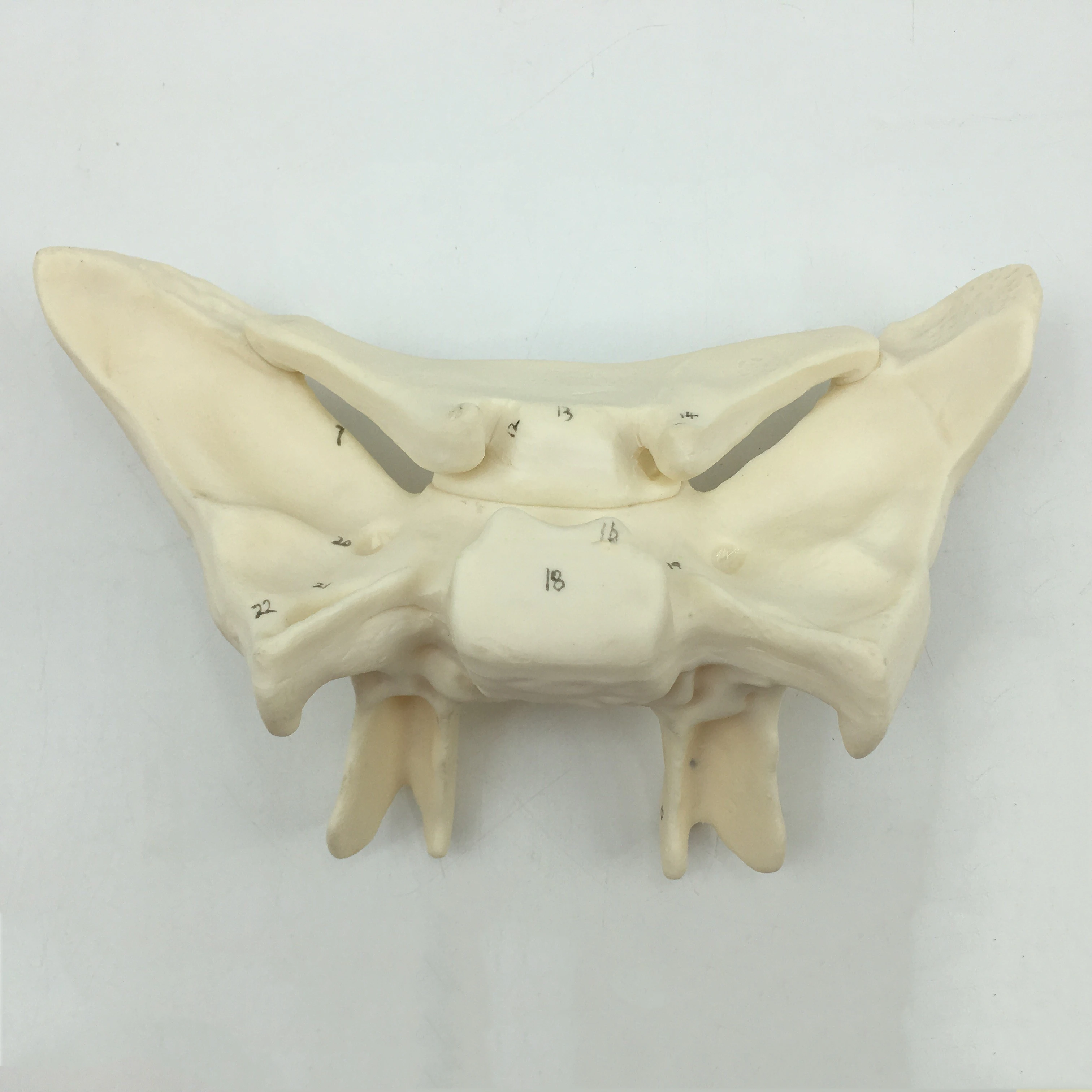 Sphenoid Enlargement Model Human Sphenoid Model Sphenoid Enlargement 3 ...