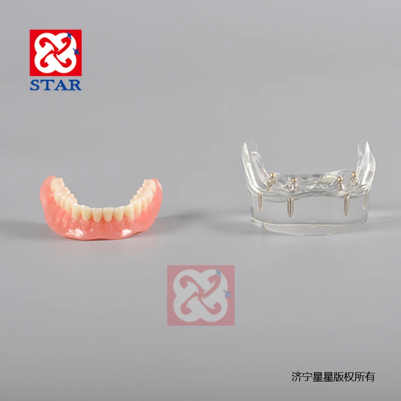 Implant All On 4 Model With Screw Driver Transparent Base With ...