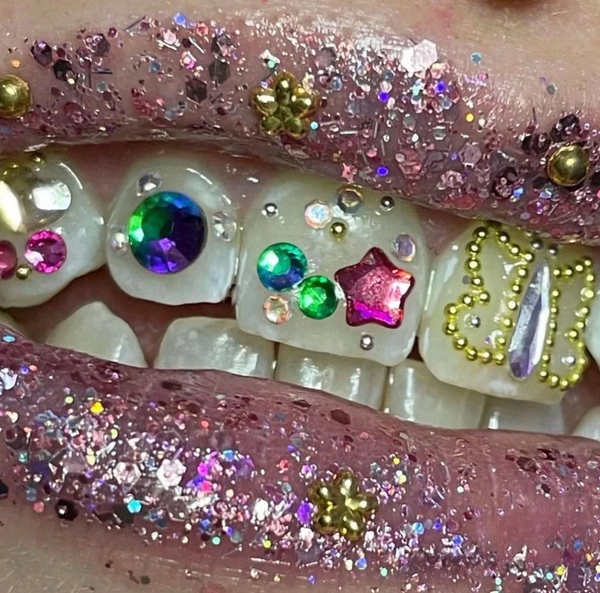 Wholesale Solid Gold Tooth Gem 18k Gold Tooth Gem Set Manufacturers ...