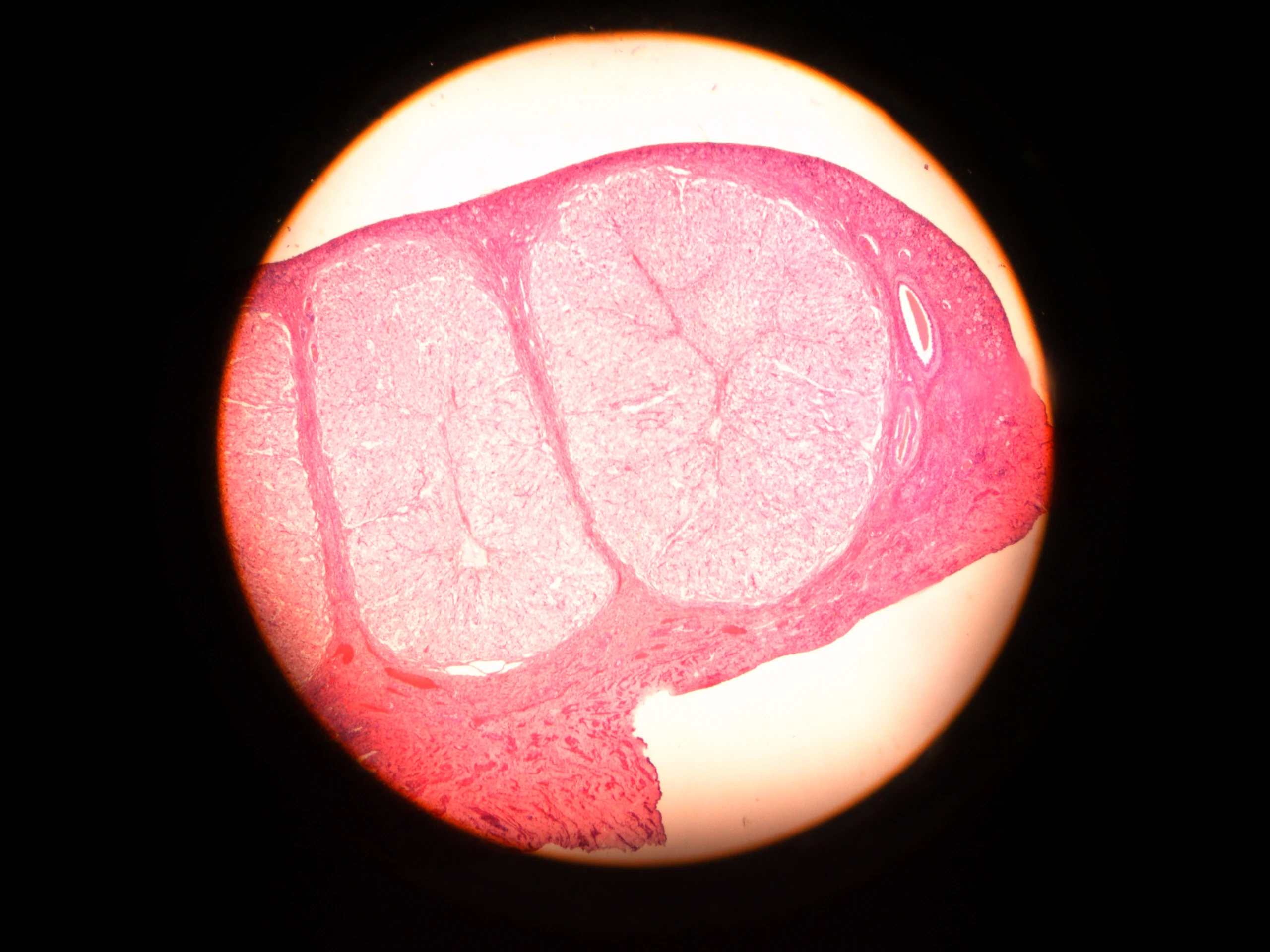 Parasite Microscope Mammal Histology Simple Squamous Epithelium Slides ...