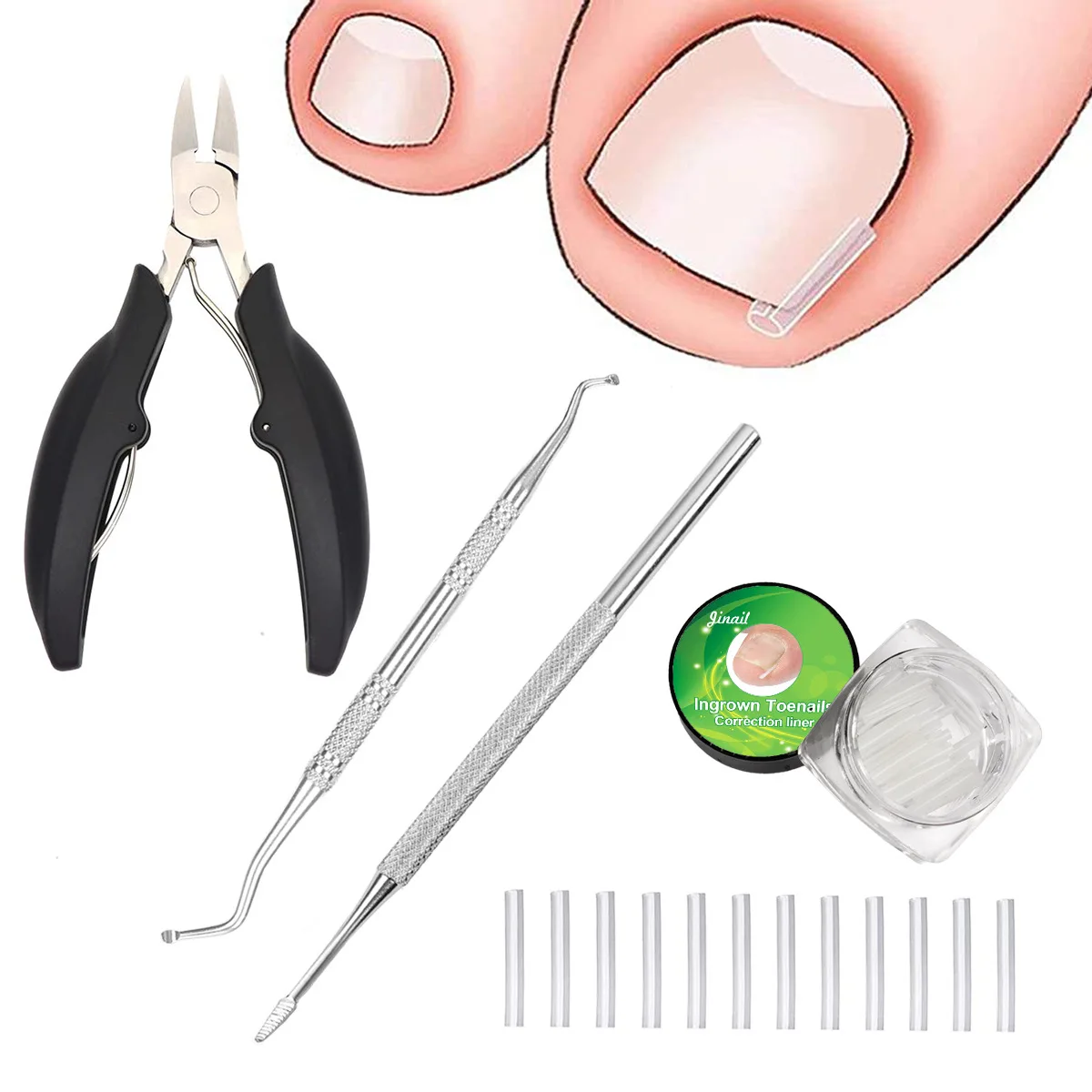 Stainless Steel Toenail Correction Pedicure Tool for Nail Recover Foot ...