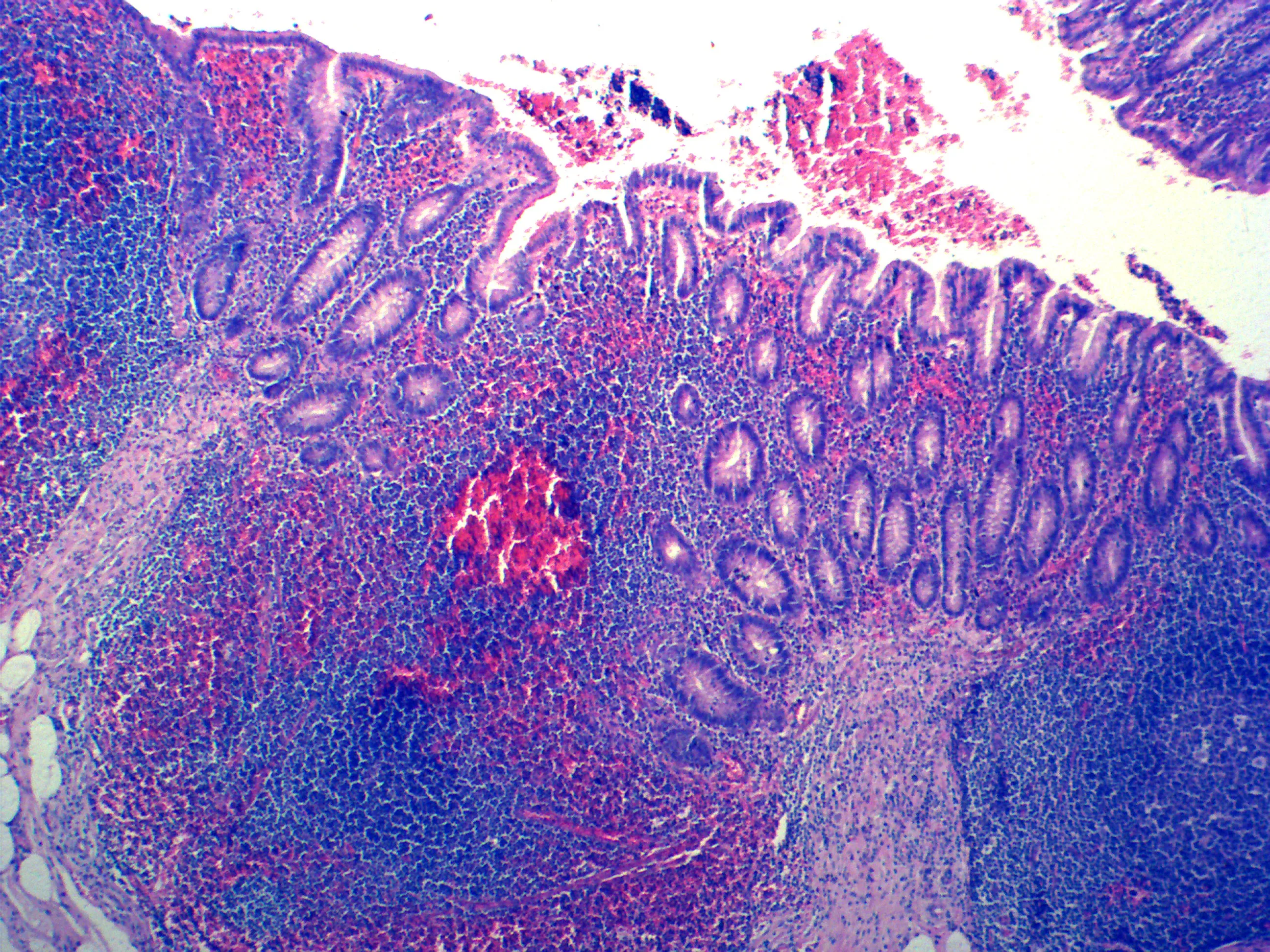 Medicine Henan Yulin Professional Human Pathology Slide About Human ...