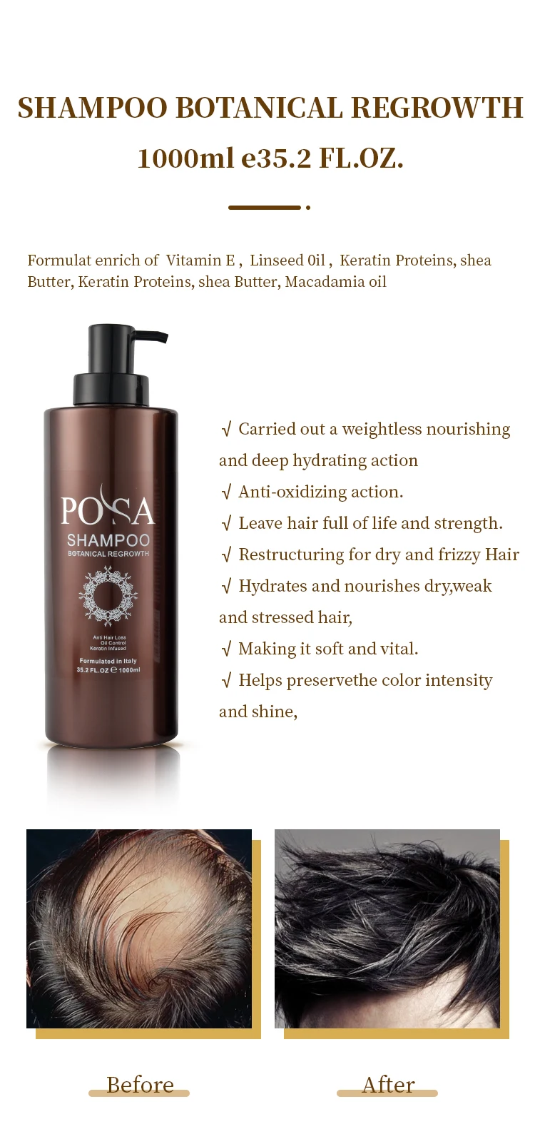 Wholesale POSA Shampoo - Anti Hair Loss & Dandruff