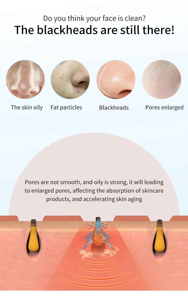 Ems Ultra Sonic Ultrasound Electric Ultrasonic Ion Facial Face Acne ...