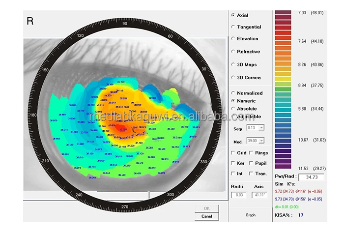 Corneal Topographer - Precision in Optometry & Ophthalmology