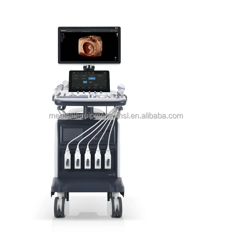 Dedicated Ultrasound Scanner S60 With Radial Scope Sonoscape Eus ...