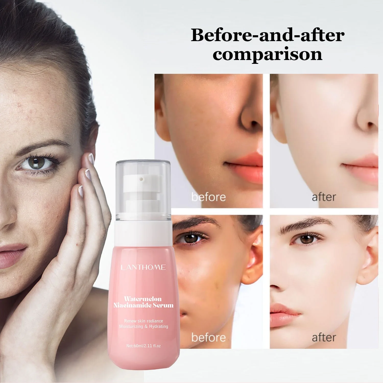 LANTHOME Watermelon Niacinamide Serum - Brighten & Moisturize