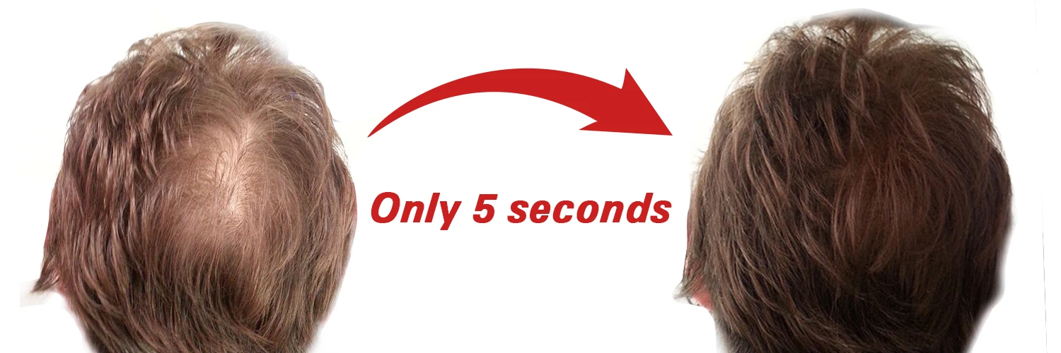Free Sample Premium Fully Hair Building Fibers Styling Hair for ...