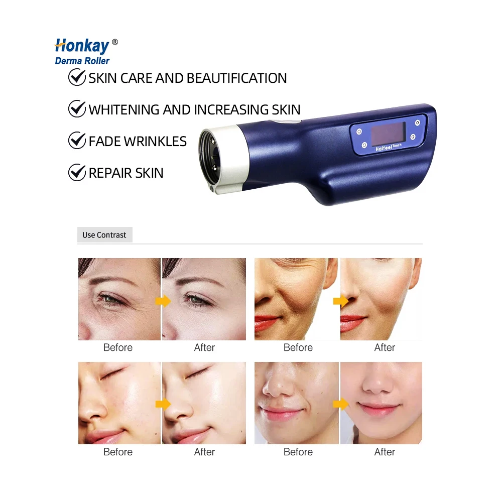 Korea Mesodermal Therapy Negative Skin Moisturizing Pressure Syringe Device Skin Rejuvenation ...