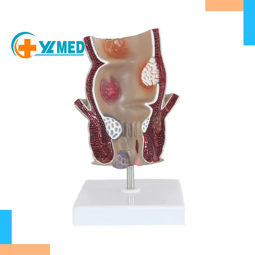 Anatomical intestinal medical anatomical model Intestinal model ...